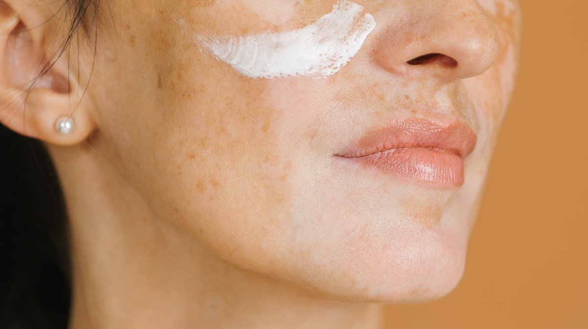 Bleaching 101: Safe and Effective Skin Lightening Options - Sage Wellness
